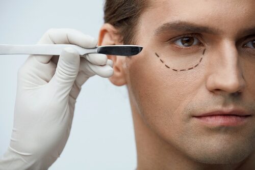 What Is Blepharoplasty and What Can It Achieve? - Longwood Eye & LASIK ...